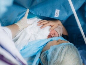 Berapa Biaya Operasi Caesar di Indonesia? Ini Rinciannya!