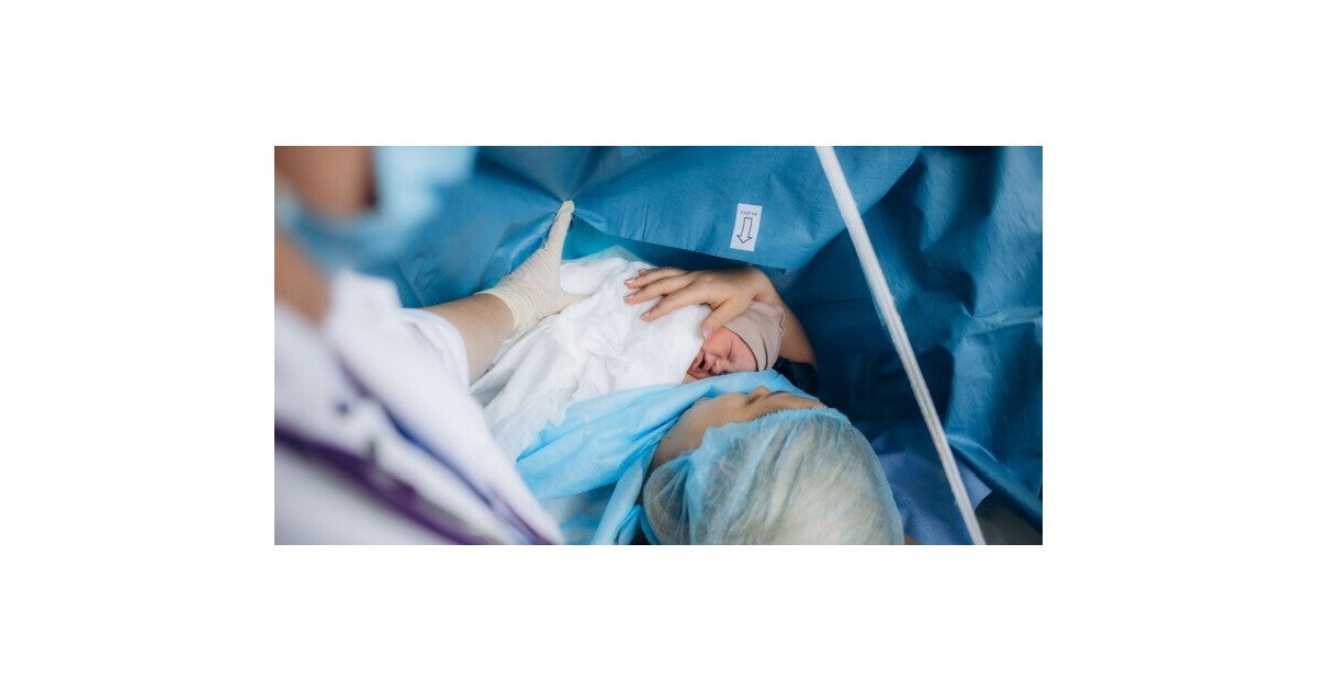 Berapa Lama Operasi Caesar? Ini Penjelasannya!