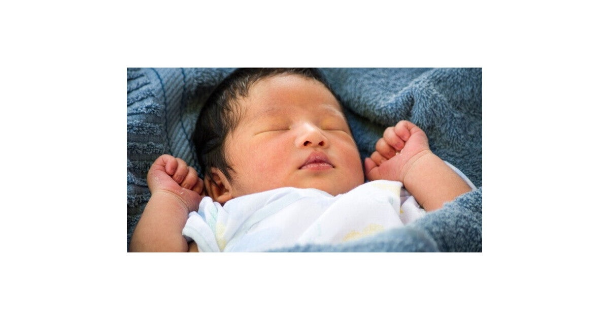 Ini Tanda Bayi Kuning yang Masih Normal dan Tidak Perlu Dikhawatirkan