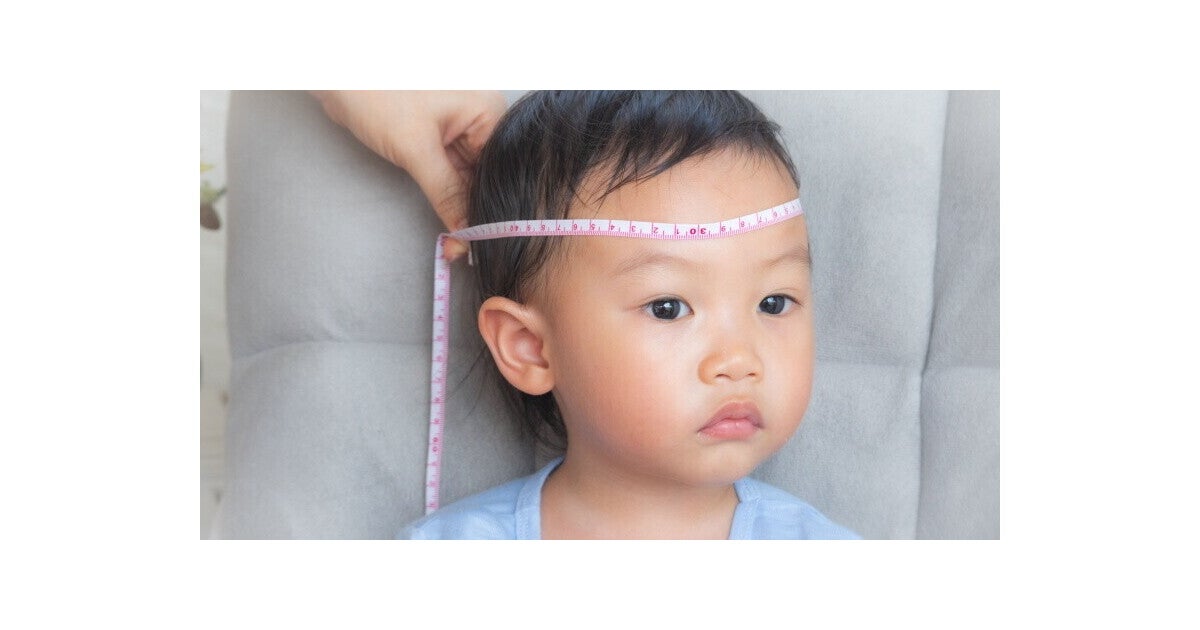 Lingkar Kepala Anak 2 Tahun: Berapa Ukuran Normalnya?